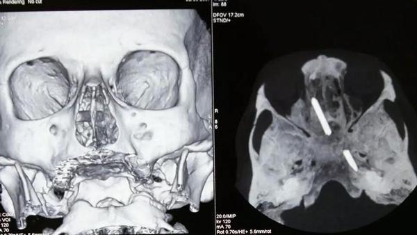 Body Invaders 1 сезон даты выхода новых серий, когда выйдет — Кино и ...